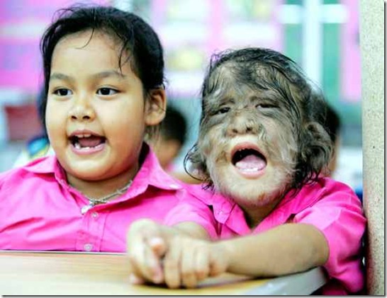 Rate #1, best ranking system: Top 10 Bizarre Birth Defects